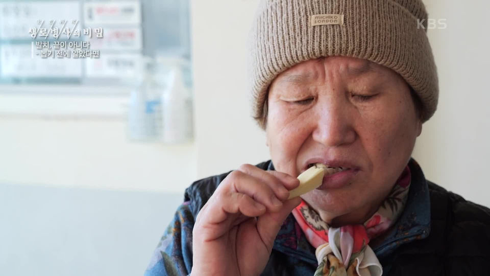 국내 치의학 보존 치료의 현주소 | KBS 230208 방송 - KBS